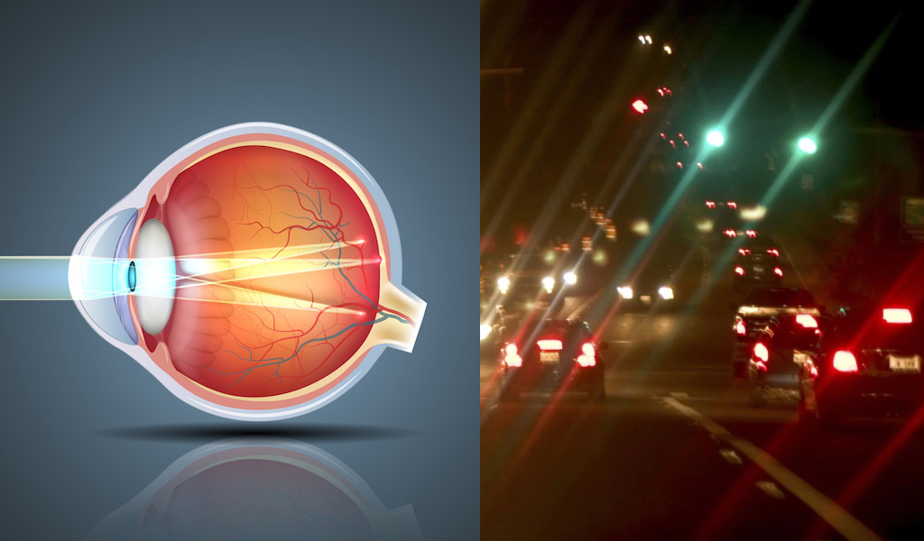 Loạn thị và 1 số điều bạn nên biết ! - AT OPTIC - Top 5 Cửa Hàng Kính ...